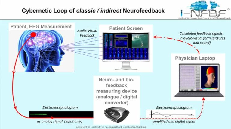 Clinical Efficacy of IASIS Micro Current Neurofeedback | IASIS Tech